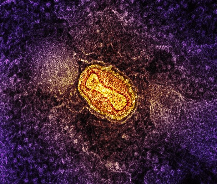 Mpox Outbreaks Continue to Spread – WiRED International